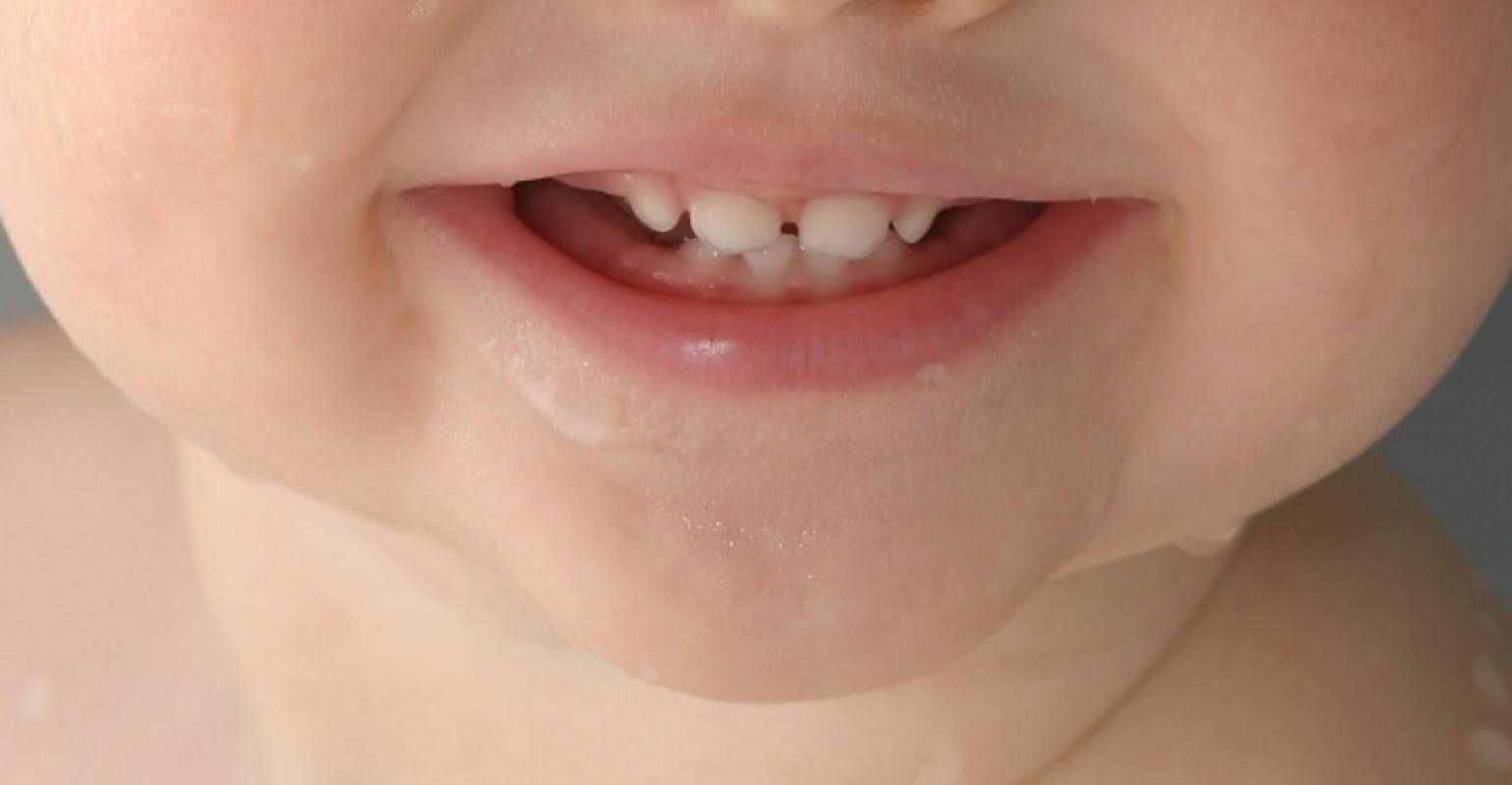 Teeth Development In Children Central Coast Orthodontics