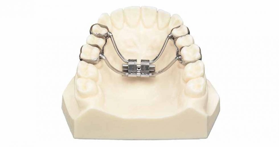 What Is Rapid Maxillary Expansion Treatment? - Central Coast Orthodontics