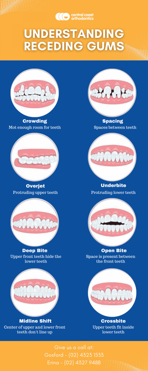 Understanding Receding Gums (INFOGRAPHIC) - Central Coast Orthodontics