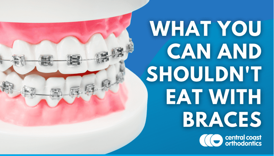 What You Can and Shouldn’t Eat with Braces - Central Coast Orthodontics
